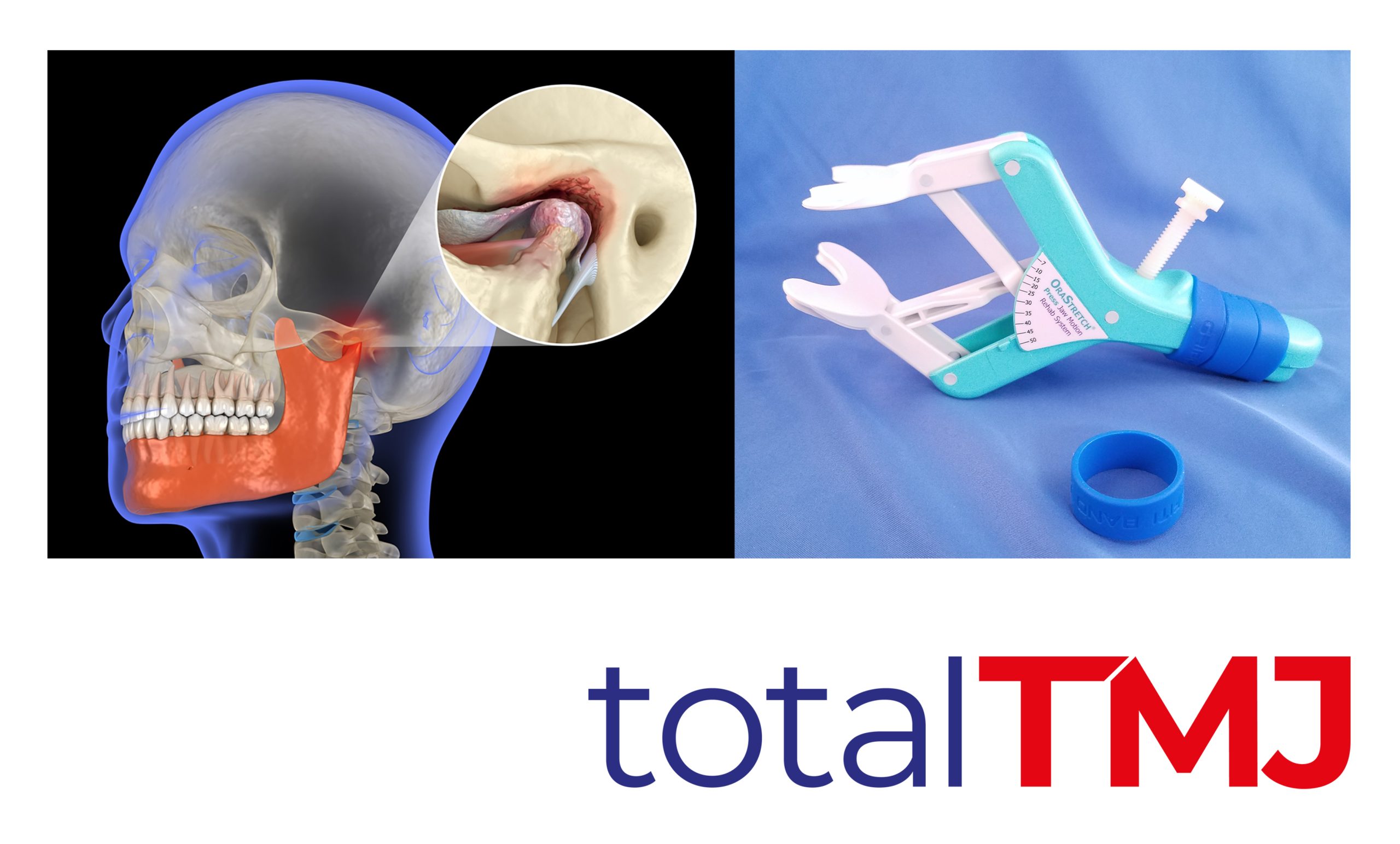 Positive progress - Smile Oral Health Matters